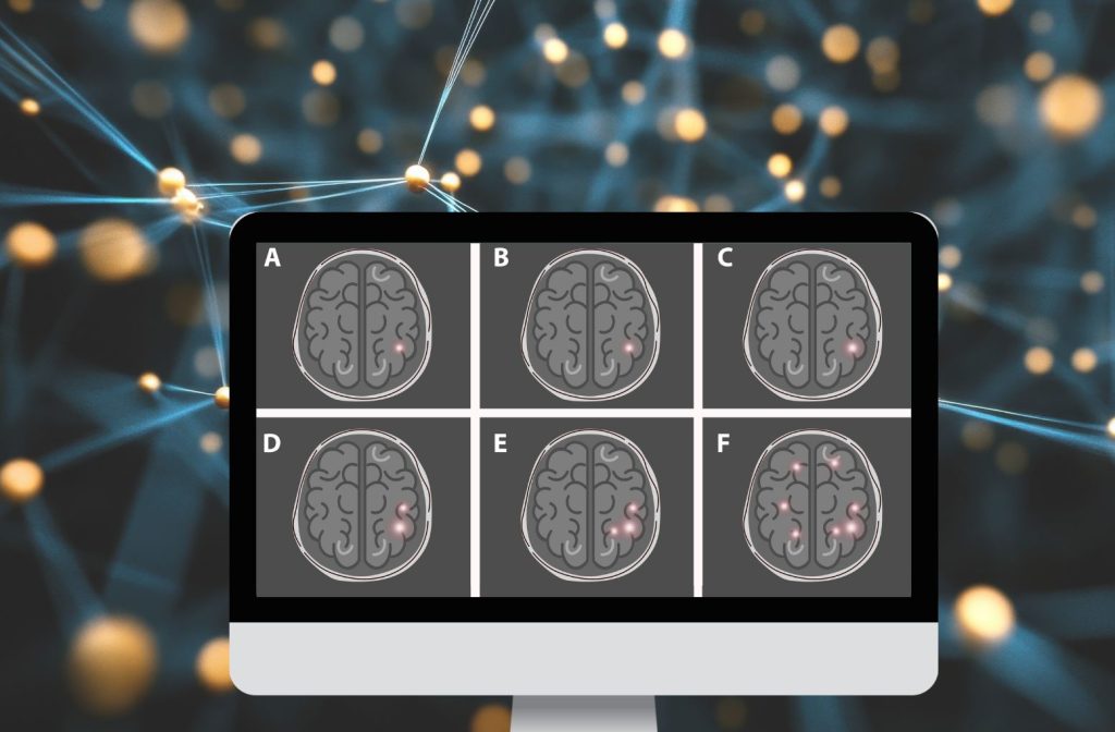 MRI Analysis Training: Psychology UGM Team Strengthens Students ...